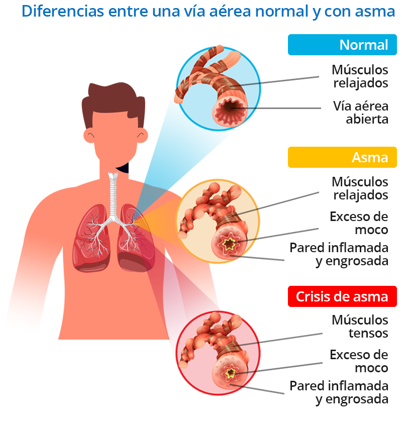 Asma - Gobierno Vasco - Euskadi.eus